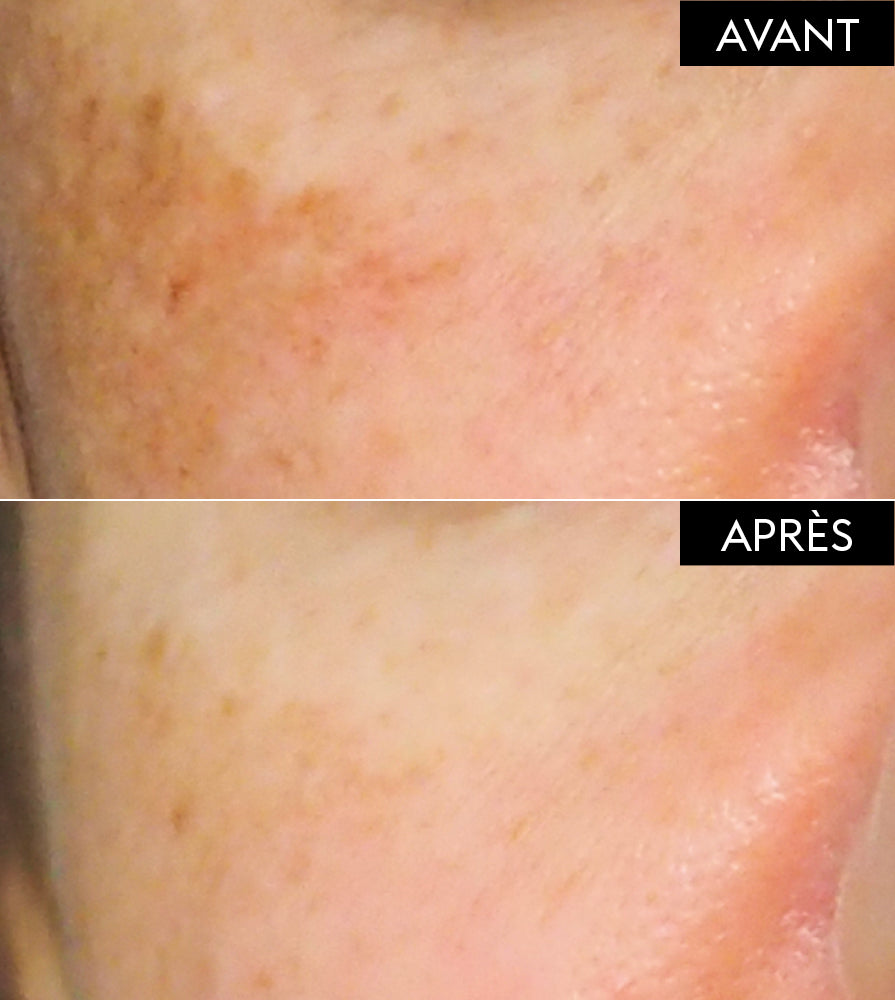 Duo Anti-Taches Perfect - Cosmétique bio - PATYKA – Patyka